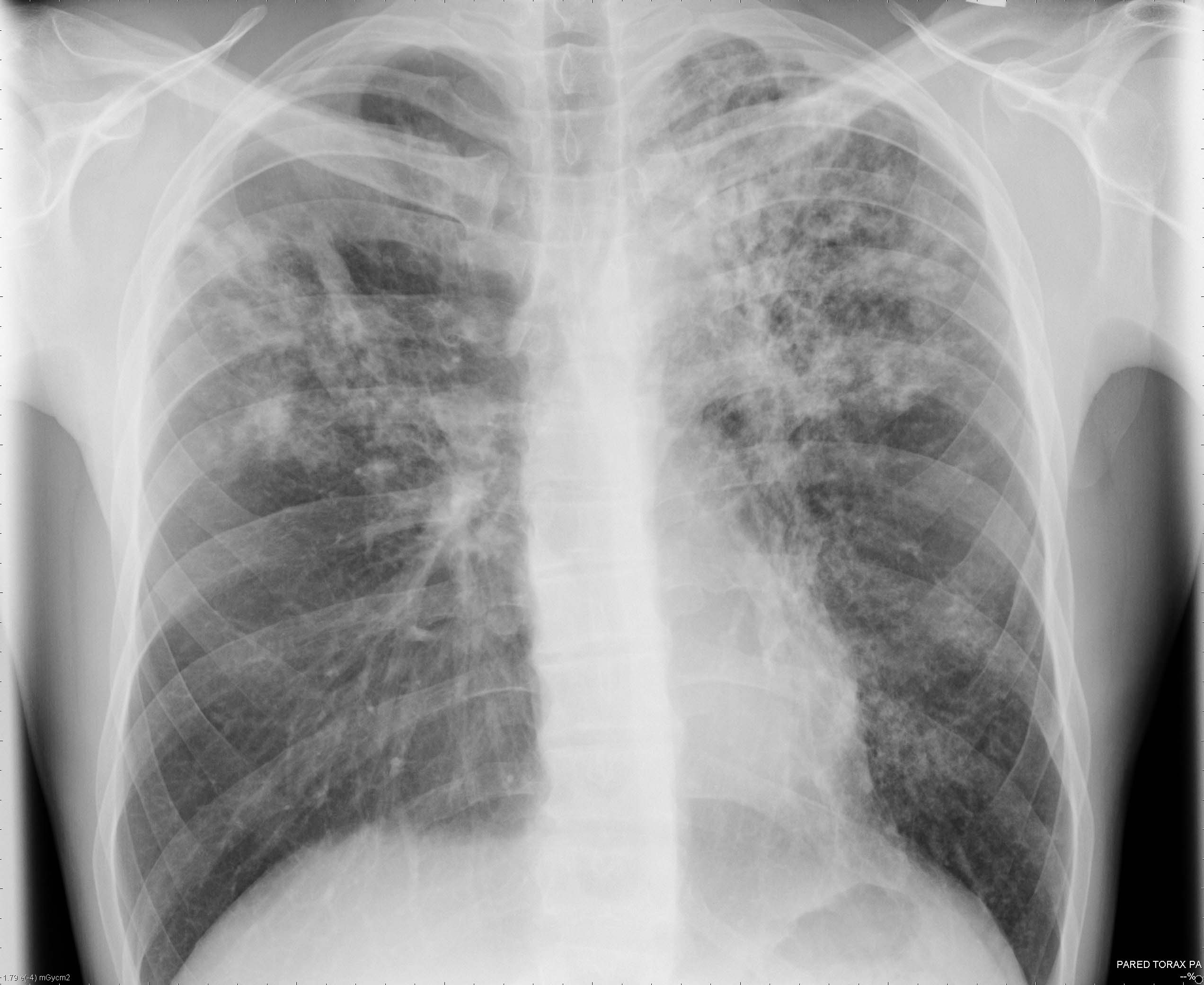 San Fernando Municipio - Programa de Tratamiento directamente observado ...